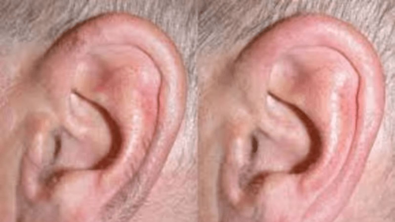 Samudrik Shastra Secrets: What Your Ear Hair Says About Your Luck ...