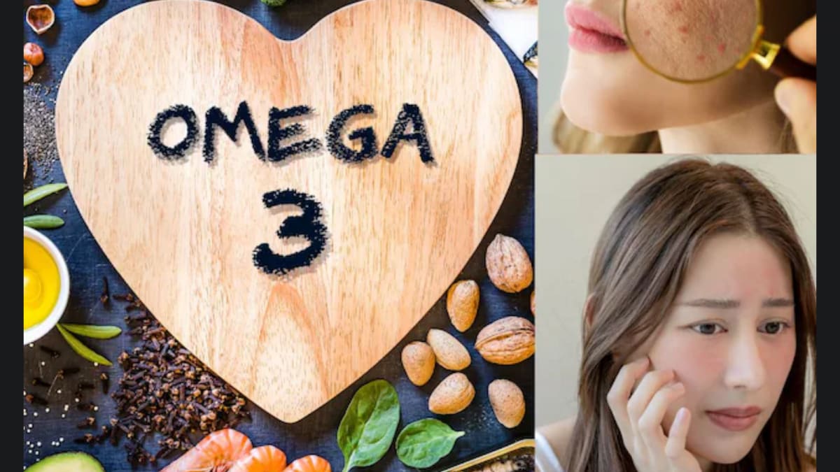 Signs Of Omega-3 Deficiency On Your Skin - Alcuse.com