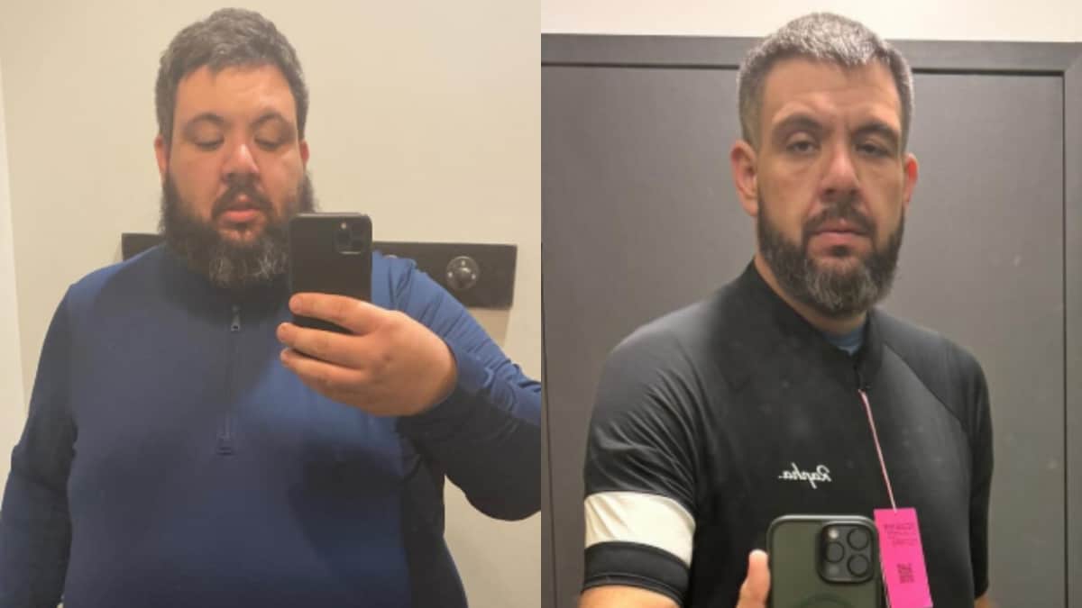 US Man’s Before-After Pics Of 125 Kg Weight Loss Journey Stun Internet ...