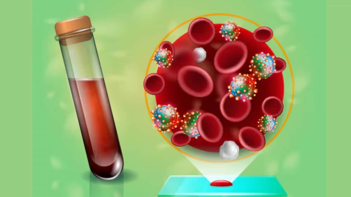 Gwada Negative: Scientists Discover World's Newest, Rarest Blood Group ...