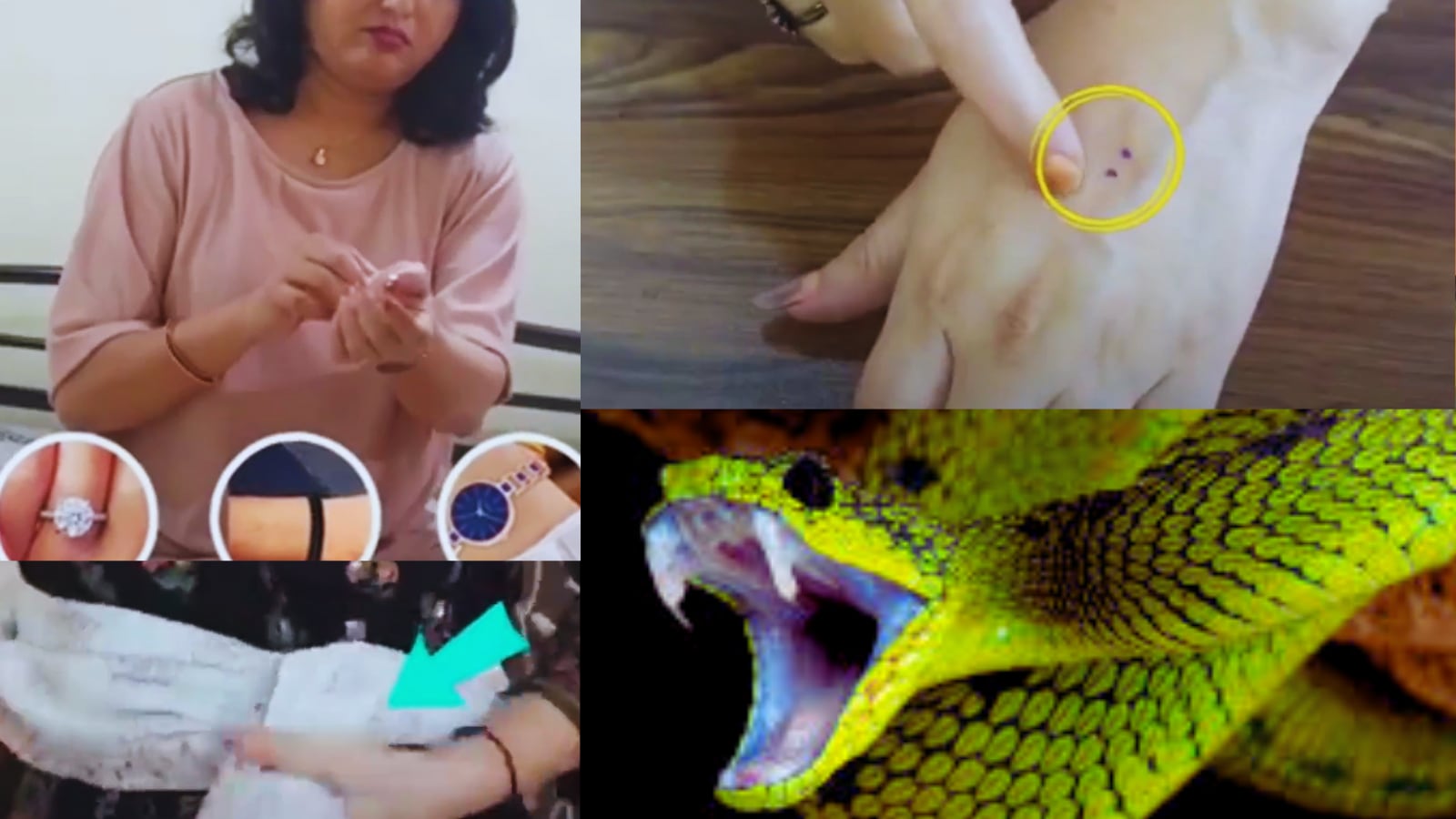 A Snake Bite Doesn’t Have To Be Fatal If You Do These Things ...