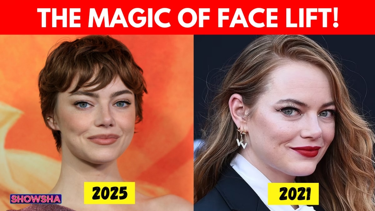 Emma Stone’s 'New Face' Sparks Buzz After Kris Jenner & Anne Hathaway’s ...