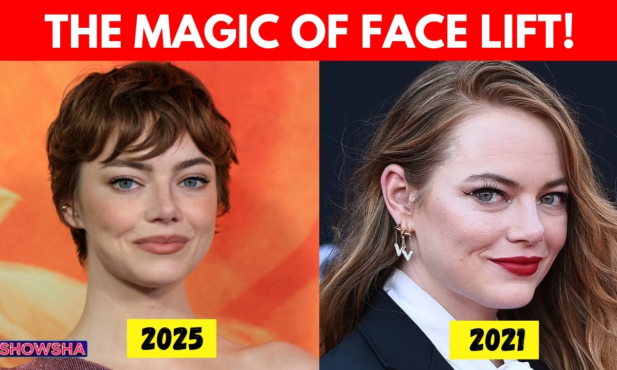Emma Stone’s 'New Face' Sparks Buzz After Kris Jenner & Anne Hathaway’s ...