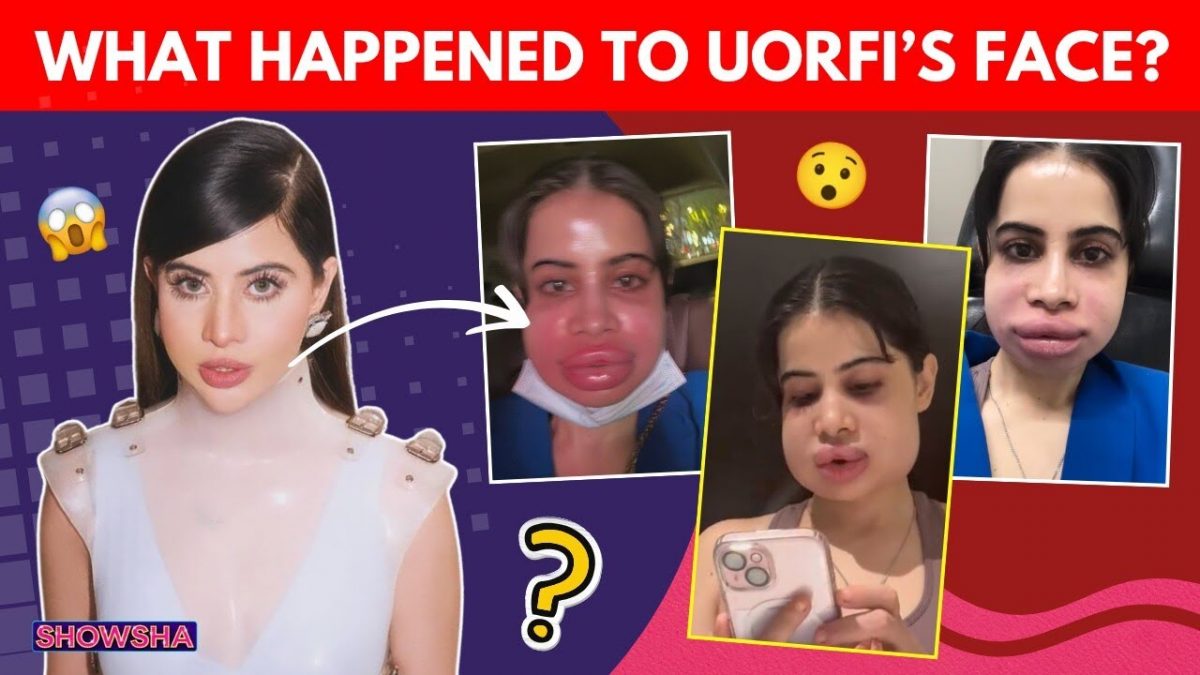 Uorfi Javed’s Swollen Face Sparks A Meme Fest But She Shares The Candid ...