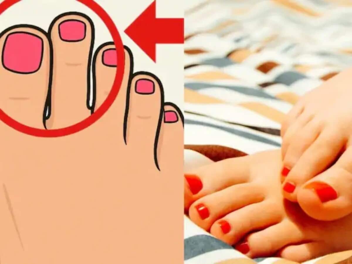 Got a Longer Second Toe? The Secret Meaning Will Surprise You - News18