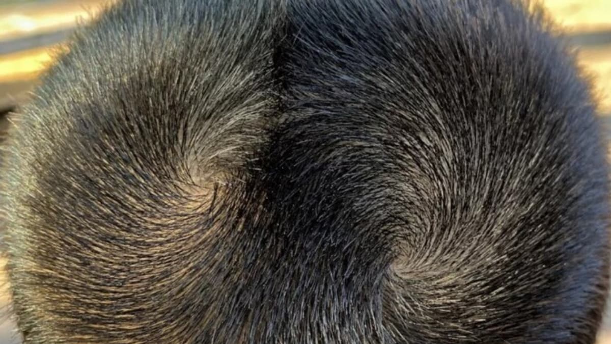 Double Whorls On The Head? Here's What Astrology Says About It!