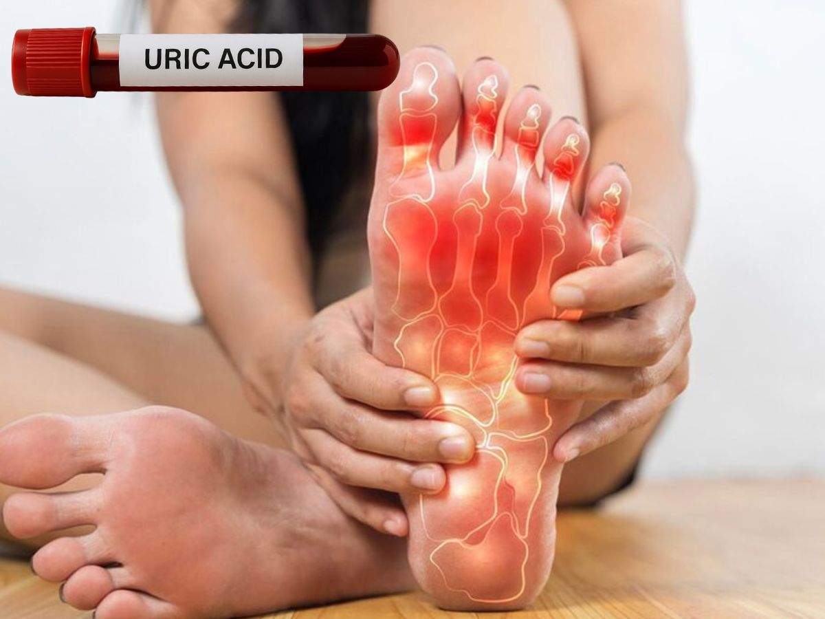 High Uric Acid? These Easy Home Tricks Could Be The Cure You're Ignoring