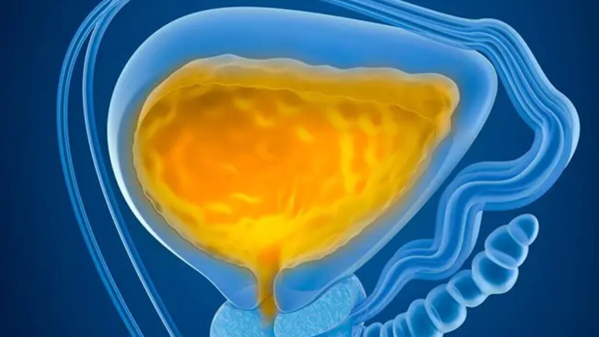 Cloudy Urine: Common Causes And What It Could Mean For Your Health ...