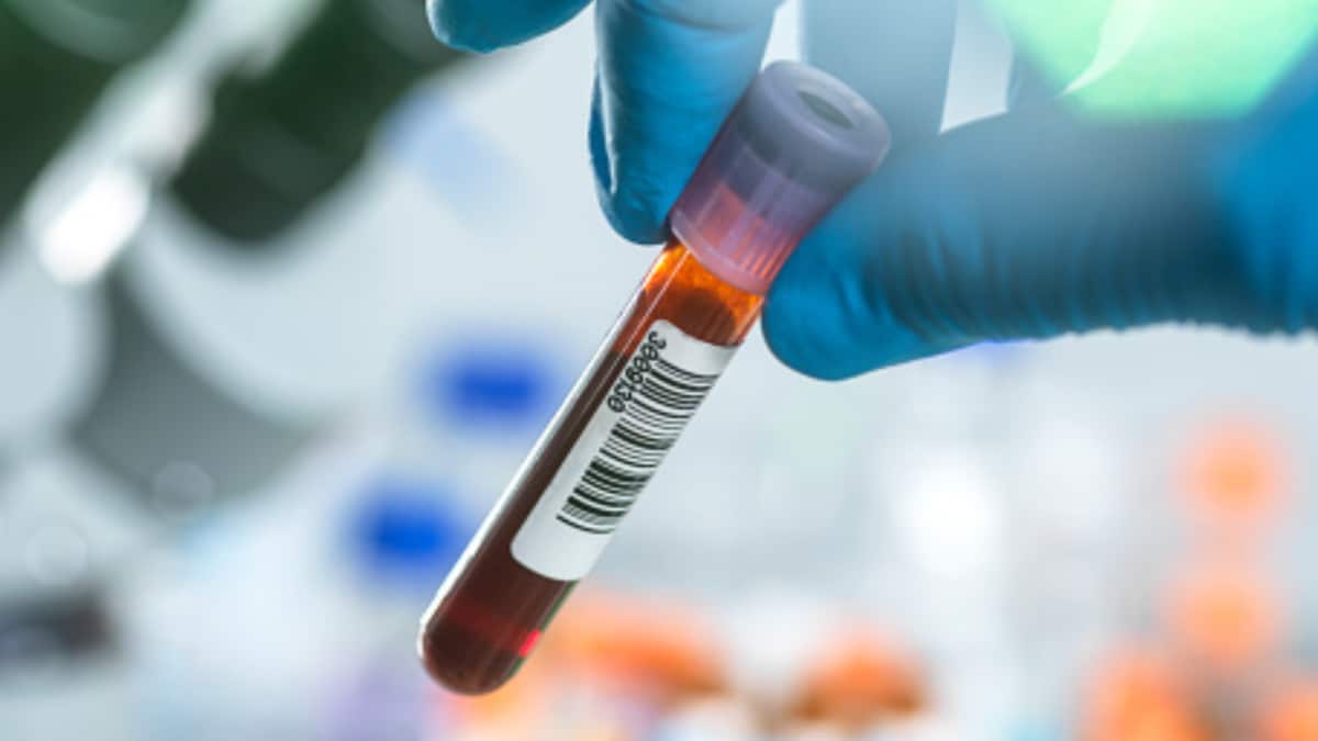 Rh Null Blood: Rarity and Importance in Transfusions Explained ...