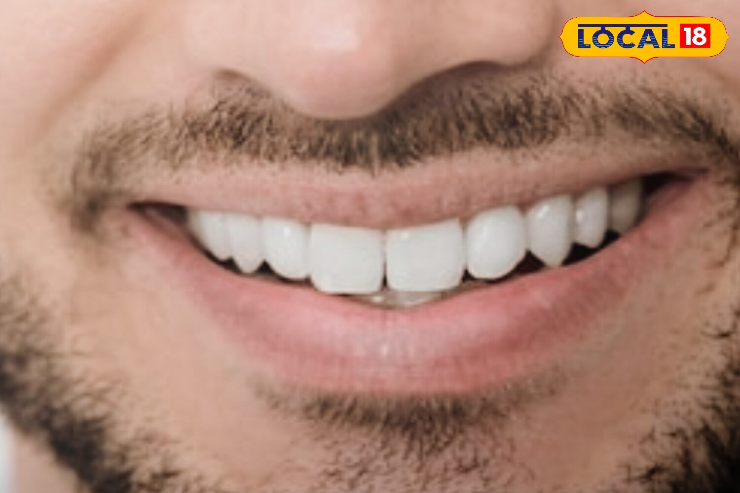 Yellow Teeth Woes? Try This Grandma’s Simple Remedy, No Costly Products ...
