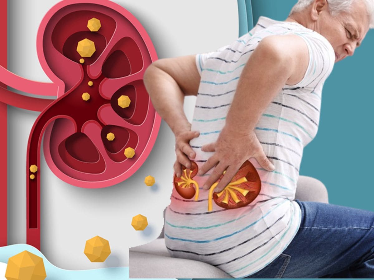 Kidney Disease Warning: 4 Early Signs Of Trouble You Should Never Ignore