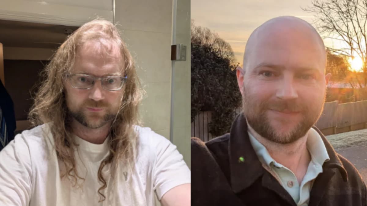 Bald And Proud: Why Reddit's r/bald Is Hair Loss's Most 'Uplifting ...