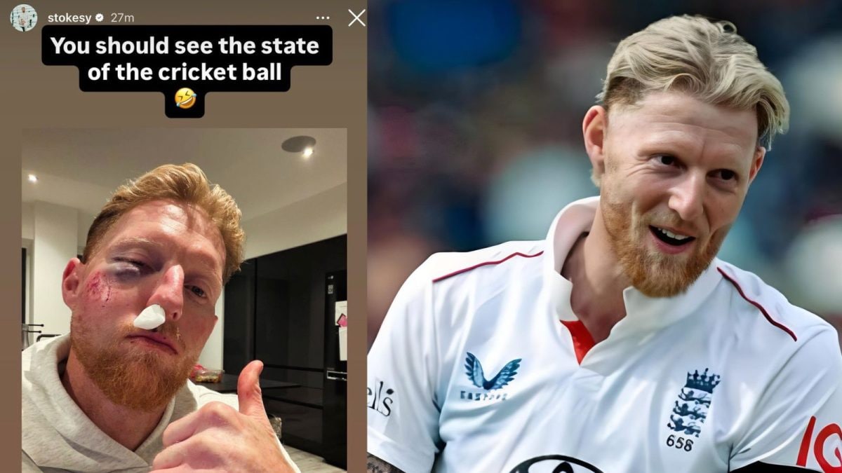Ben Stokes Suffers Facial Injury In Training! But 'You Should See The ...
