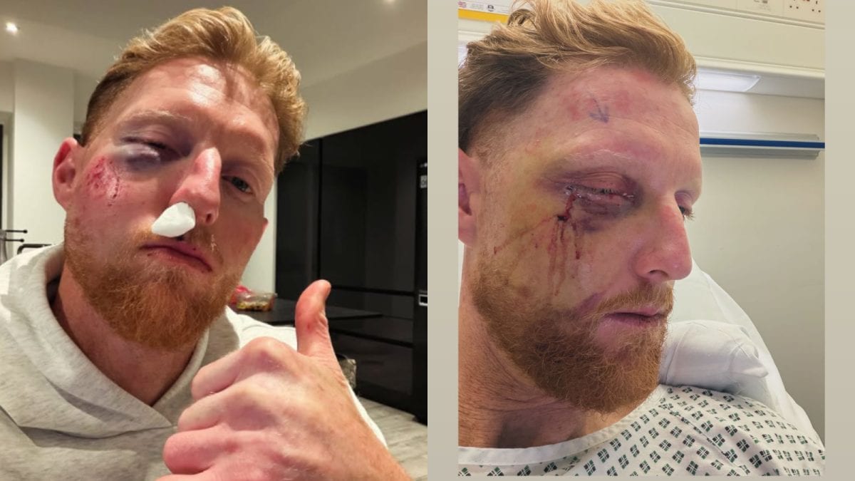 England Test Captain Ben Stokes Undergoes Successful Eye Surgery ...