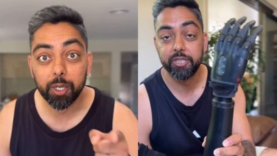 Man ‘Upgrades’ Life With Bionic Arm: What Is It? How Is This Technology ...