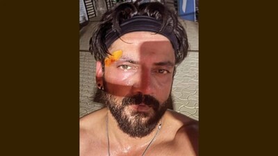 Zaheer Iqbal Injures Eyebrow During Padel Game, Shares Bandaged Picture ...