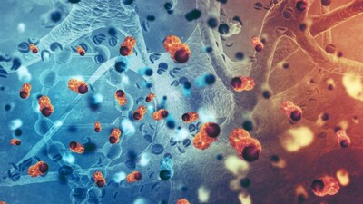Scientists Develop Handheld Cancer Detector That Can Identify Early ...