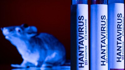 Deadly Hantavirus Cruise Ship Outbreak: List Of Countries That Have ...