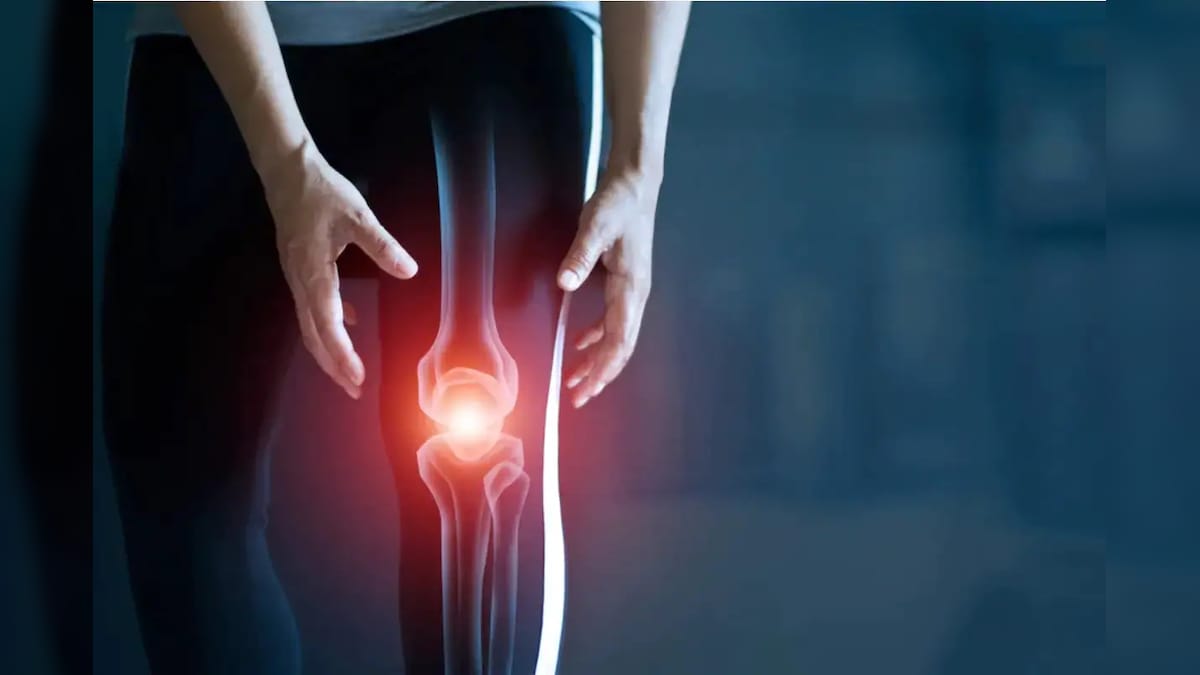 कोरोनानंतर Bone death चा धोका; नेमका काय आहे हा आजार? – News18 लोकमत