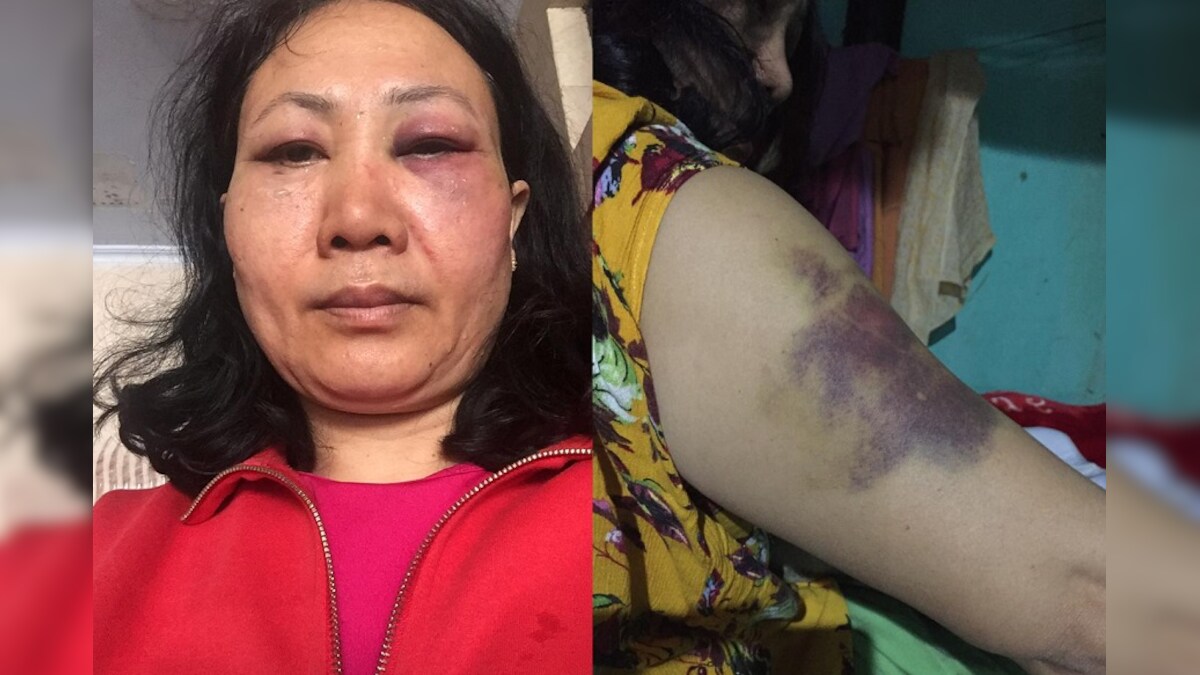 ವರದಕ್ಷಿಣೆ ಕಿರುಕುಳ: ಭಾರತದ ಹಾಕಿ ಮಹಿಳಾ ತಂಡದ ಮಾಜಿ ನಾಯಕಿ ಮೇಲೆ ಗಂಡನಿಂದ ...