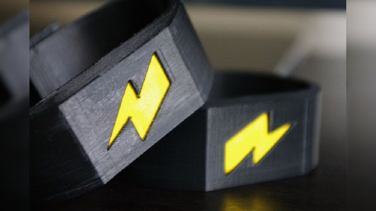 Electric Shock Bracelet: ಡಯೆಟ್ ಮಾಡುವವರಿಗೆ ಬೆಸ್ಟ್ ! ಜಾಸ್ತಿ ತಿಂದರೆ ಶಾಕ್ ...