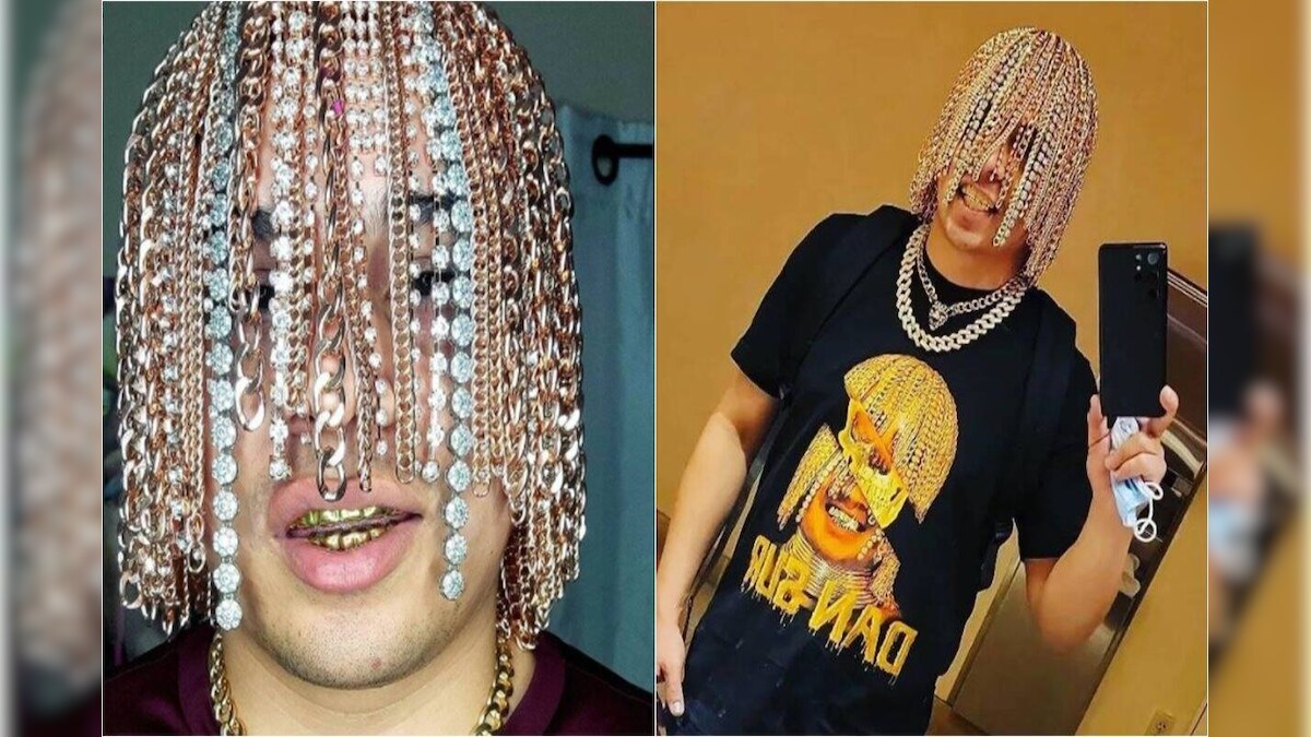 Trending| ಚಿನ್ನದ ಚೈನ್ ಕೊಕ್ಕೆಗಳನ್ನು ತಲೆಯ ಮೇಲೆ ಶಸ್ತ್ರ ಚಿಕಿತ್ಸೆಯಿಂದ ...