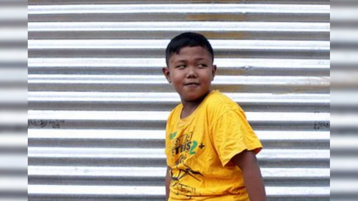 Ardi Rizal: ದಿನಕ್ಕೆ 40 ಸಿಗರೇಟ್ ಸೇದುತ್ತಿದ್ದ ಈ ಬಾಲಕ ಈಗ ಹೇಗಿದ್ದಾನೆ ಗೊತ್ತಾ ...