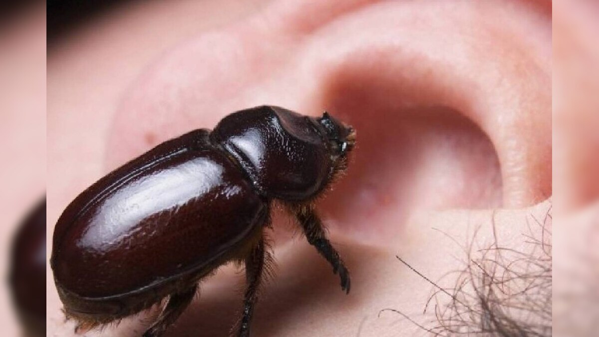 Insect in Ear: ಕಿವಿಯೊಳಕ್ಕೆ ಕೀಟ ಹೊಕ್ಕರೆ ಮೊದಲೇನು ಮಾಡಬೇಕು? – News18 ಕನ್ನಡ