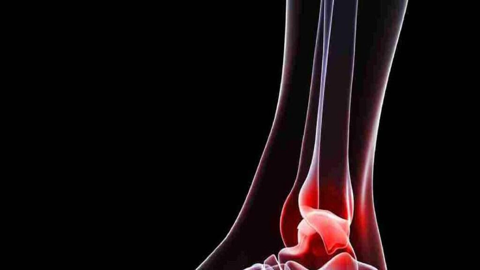 cancer-what-is-bone