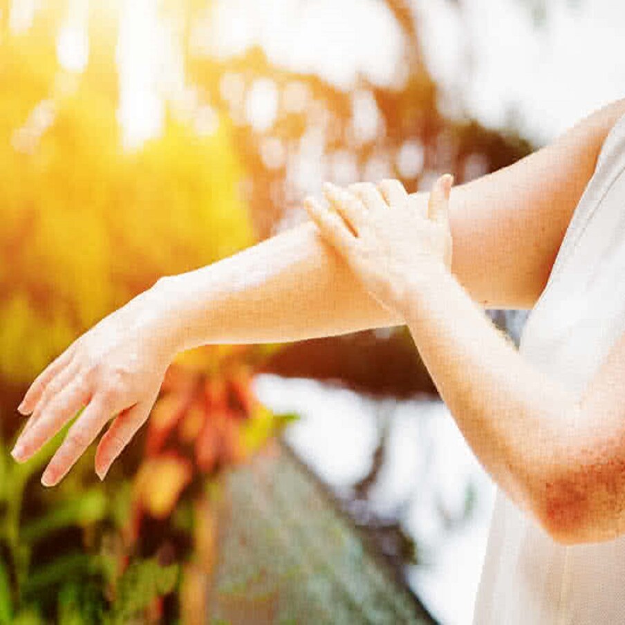 What is Nairobi Fly Nairobi Flies Burns Skin of Sikkim Students ’ What ...