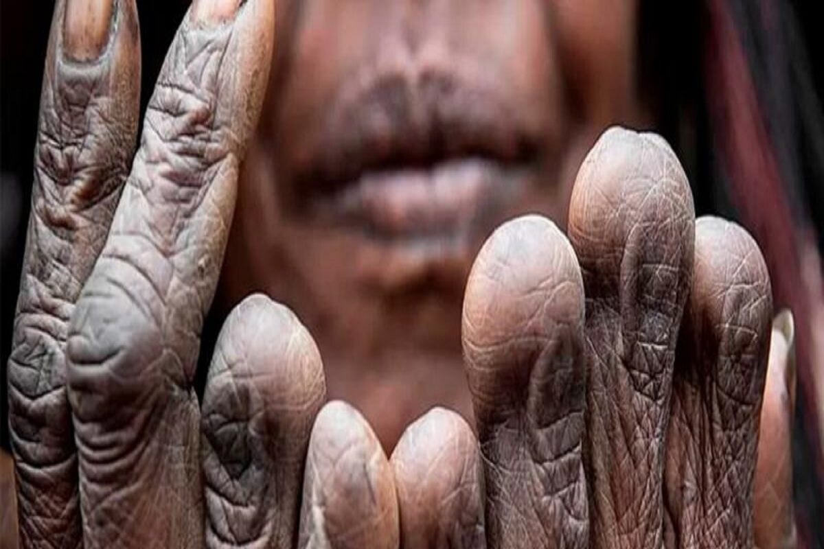 Ikipalin: ಸಂಬಂಧಿಕರು ಸಾವನ್ನಪ್ಪಿದರೆ ತಮ್ಮ ಬೆರಳುಗಳನ್ನು ಕತ್ತರಿಸಿಕೊಳ್ತಾರೆ ಈ ...