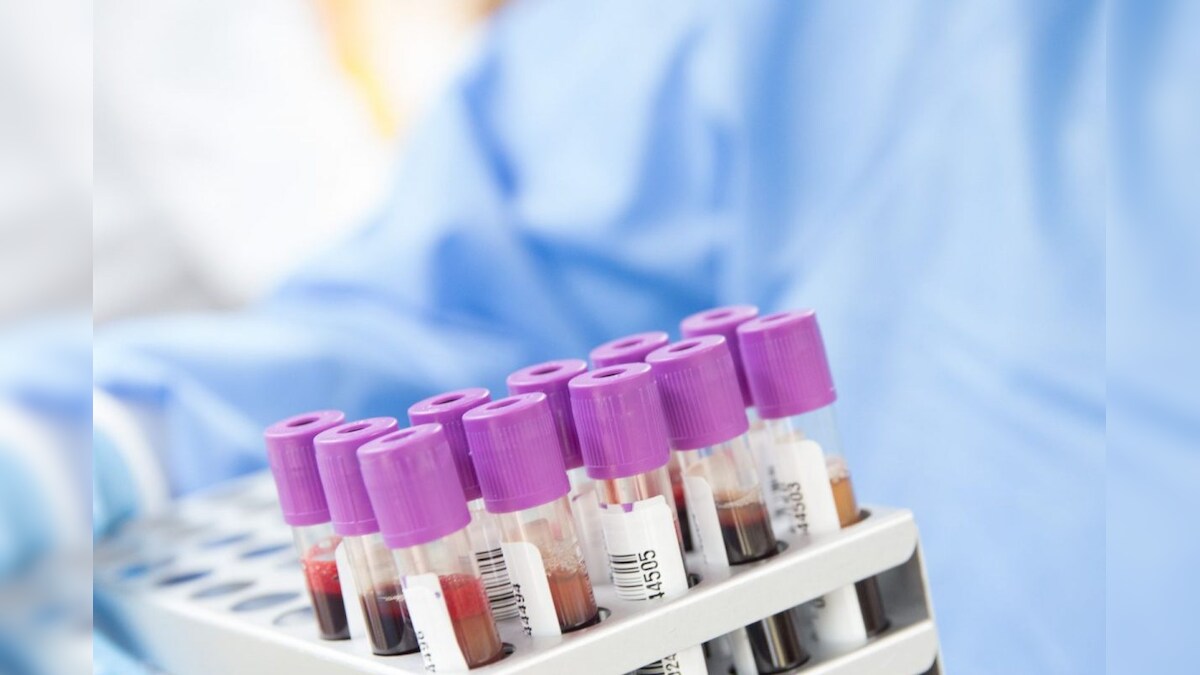 Lab Grown Blood: ವಿಶ್ವದಲ್ಲೇ ಮೊದಲ ಬಾರಿ ಮಾನವ ದೇಹ ಸೇರಲಿದೆ ಲ್ಯಾಬ್‌ನಲ್ಲಿ ...