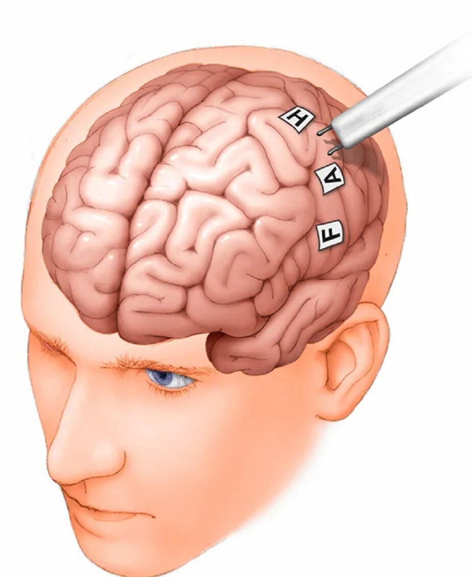 Brain Mapping Test: ಬೆಂಗಳೂರಿಗೆ ಬಂತು ಬ್ರೇನ್ ಮ್ಯಾಪಿಂಗ್ ಟೆಸ್ಟ್ ...