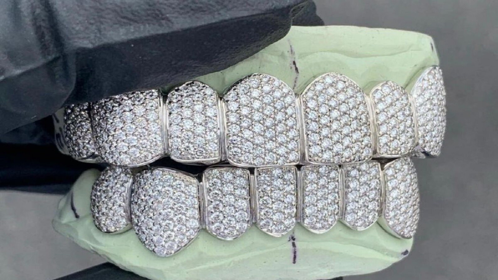 Diamond Teeth: ವಿದೇಶದಲ್ಲಿ ಬೇಡಿಕೆಯಿರುವ ವಜ್ರದ ಹಲ್ಲುಗಳು ನಿಮಗೂ ಬೇಕೆ? ಸೂರತ್ ...