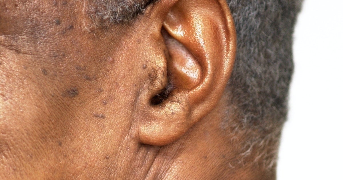 Hairs In Ear: ಕಿವಿಯ ಮೇಲೆ ಕೂದಲಿದ್ರೆ ಅದೃಷ್ಟನಾ? ಇಲ್ಲಿದೆ ನೋಡಿ ಮಾಹಿತಿ ...