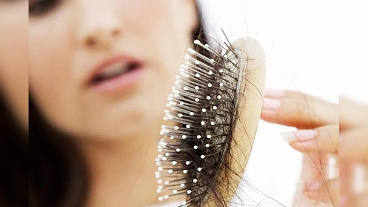 Hair Fall: ಯಾವ ವಿಟಮಿನ್ ಕೊರತೆಯಿಂದ ಕೂದಲು ಉದುರುತ್ತೆ? ಅದಕ್ಕಾಗಿ ಏನನ್ನು ...