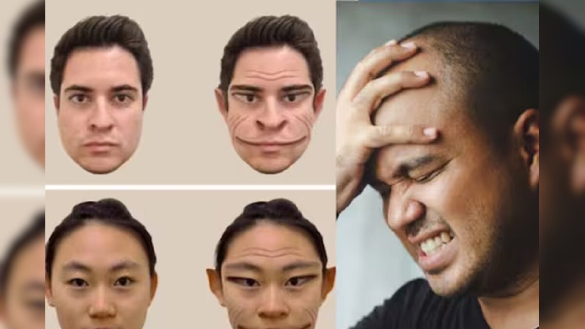 Weird News: ವಿಚಿತ್ರ ಕಾಯಿಲೆಯಿಂದ ಬಳಲುತ್ತಿದ್ದಾನೆ ಈ ವ್ಯಕ್ತಿ! ಈತ ಯಾರನ್ನೇ ...