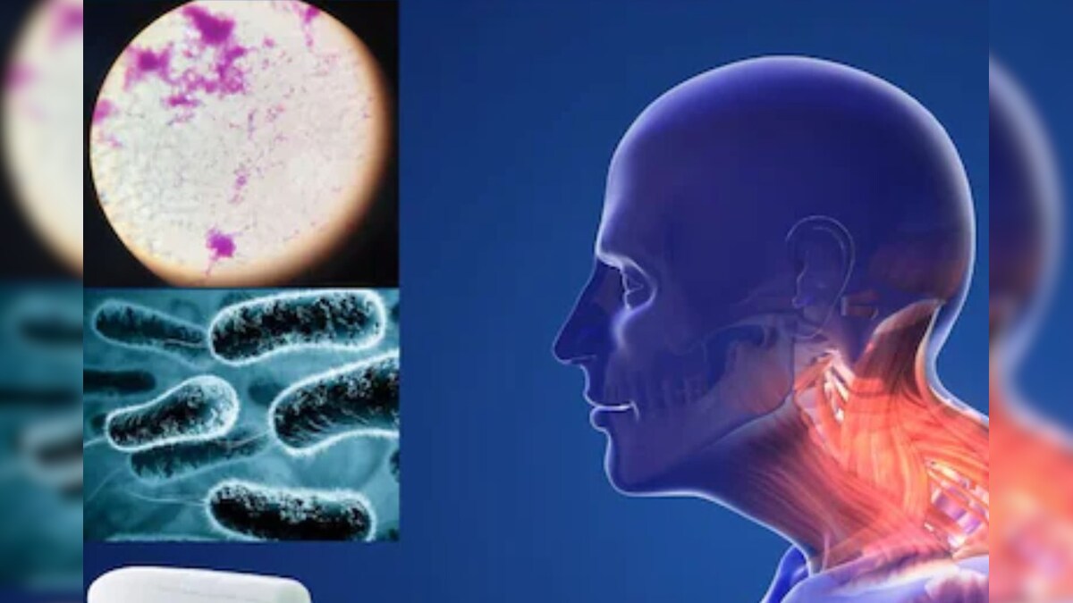 STSS Japan: ಈ ಬ್ಯಾಕ್ಟೀರಿಯಾ 48 ಗಂಟೆ ದೇಹದಲ್ಲಿದ್ದರೆ ಸಾವು ಖಚಿತ, ಟ್ಯಾಂಪೂನ್ ...