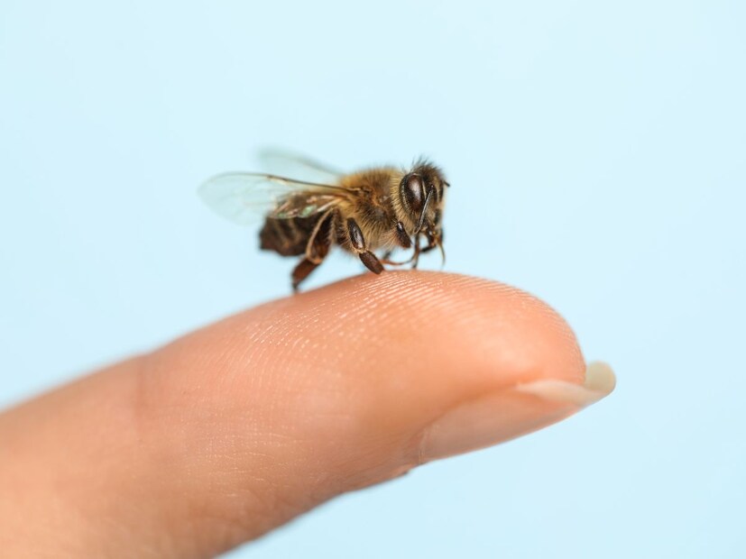 Bee Bite: ಜೇನುಹುಳ ಕಚ್ಚಿದಾಗ ಏನು ಮಾಡ್ಬೇಕು? ಉರಿಯೂತ ನಿವಾರಣೆಗೆ ಇಲ್ಲಿದೆ ನೋಡಿ ...