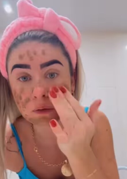 Viral News: ಮುಖದ ಸೌಂದರ್ಯಕ್ಕೆ ತನ್ನದೇ ಮಲ ಹಚ್ಚುತ್ತಾಳೆ ಈ ಮಾಡೆಲ್; ವಿಡಿಯೋ ...