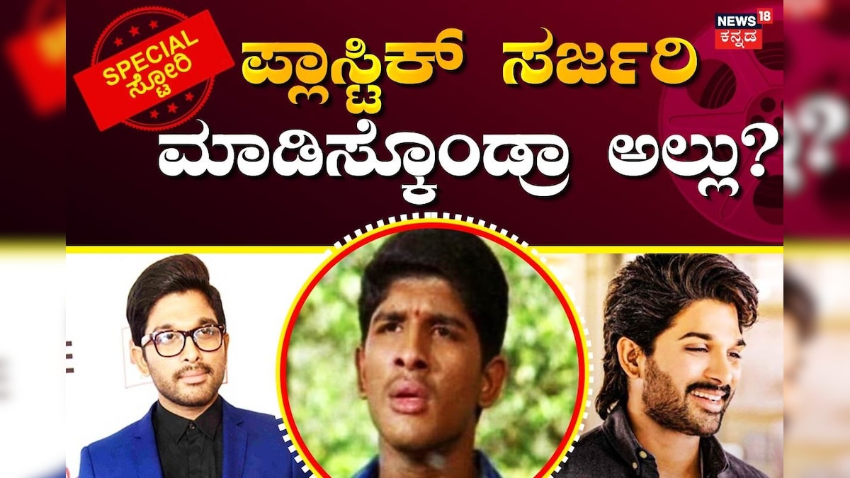 Allu Arjun: ಮೂಗಿಗೆ ಪ್ಲಾಸ್ಟಿಕ್ ಸರ್ಜರಿ ಮಾಡಿಸ್ಕೊಂಡ್ರಾ ಸ್ಟೈಲಿಷ್ ಸ್ಟಾರ್ ...
