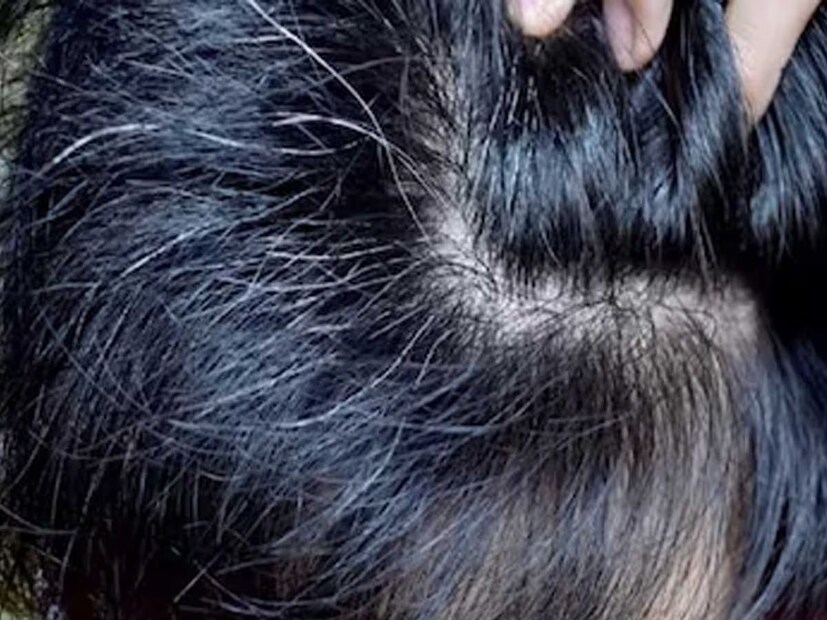 White Hair: ತಲೆಯಲ್ಲಿ, ಗಡ್ಡದಲ್ಲಿ ಒಂದು ಬಿಳಿ ಕೂದಲು ಕೀಳುವುದರಿಂದ ನಿಜಕ್ಕೂ ...