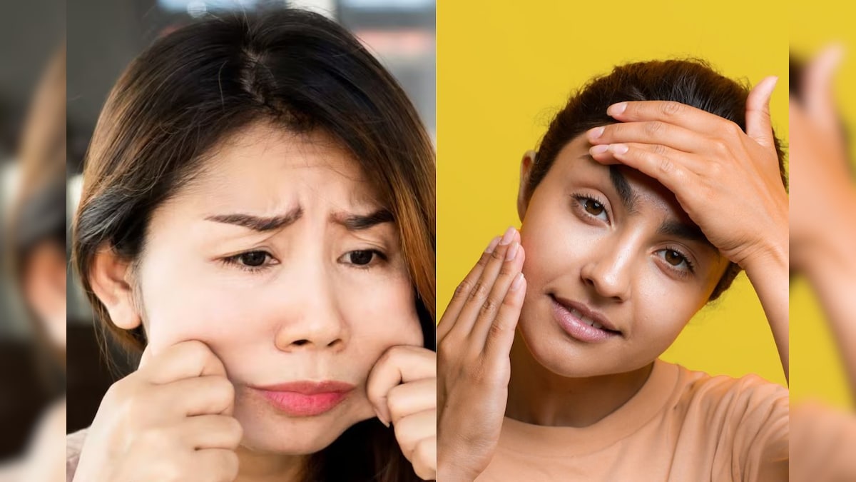 Face Fat: ಮುಖದಲ್ಲಿರುವ ಕೊಬ್ಬನ್ನು ಕಡಿಮೆ ಮಾಡುತ್ತವಂತೆ ಈ 5 ಯೋಗಾಸನಗಳು! | 5 yoga poses to reduce face ...