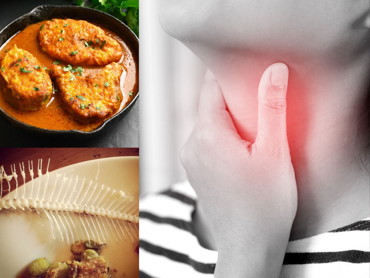 Fish Bones Stuck In Throat: ಅಯ್ಯೋ, ಮೀನು ತಿನ್ನುವಾಗ ಗಂಟಲಲ್ಲಿ ಮುಳ್ಳು ...