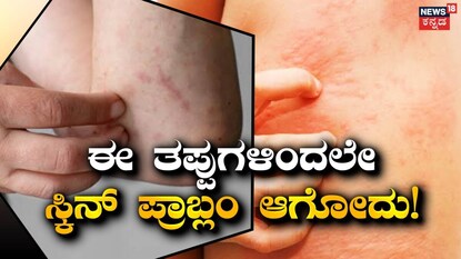 ಚರ್ಮದ ಸಮಸ್ಯೆಗಳಿಂದ ಬಳಲುತ್ತಿದ್ದೀರಾ? ಮೊದಲು ಈ ತಪ್ಪುಗಳನ್ನು ಮಾಡೋದು ನಿಲ್ಲಿಸಿ ...