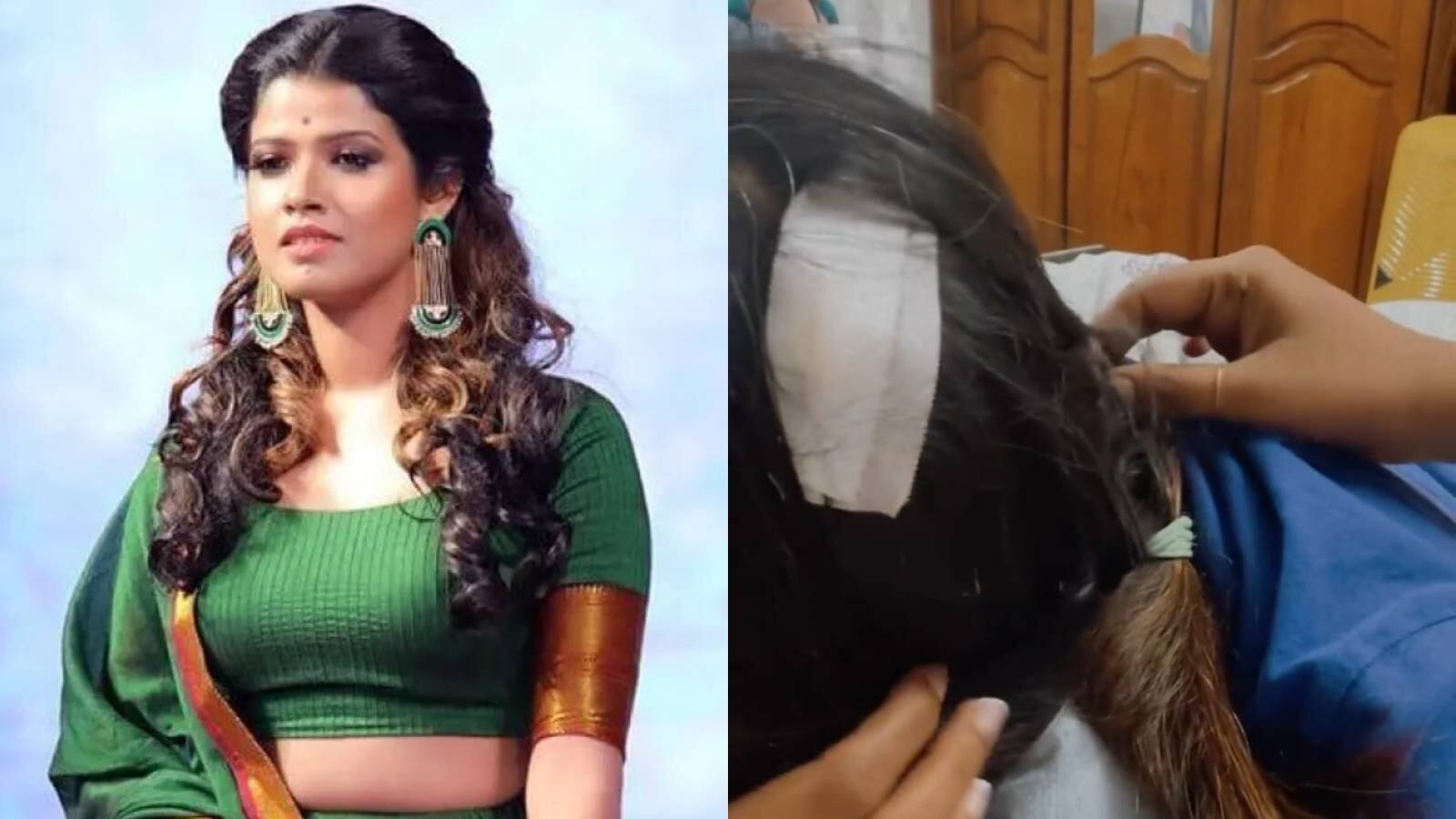 Amrutha Suresh | അമൃത സുരേഷിന് തലയ്ക്കു പിന്നിൽ പരിക്ക്; രണ്ട് ...