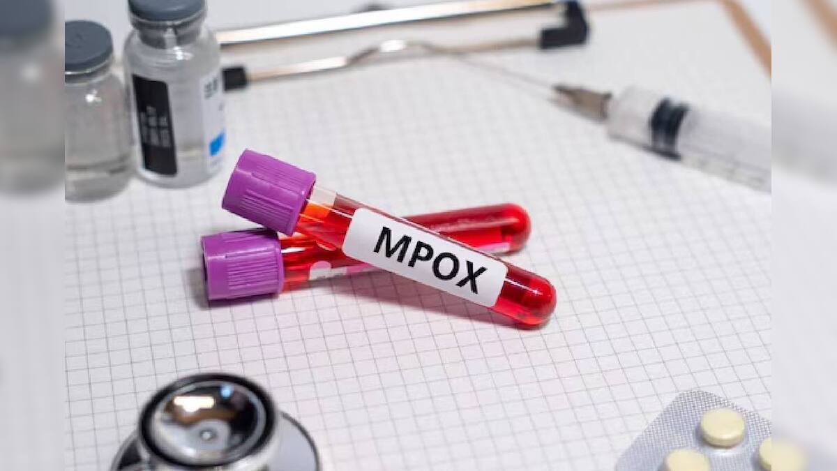 Mpox: അന്താരാഷ്ട്ര വിമാനത്താവളങ്ങളിൽ ജാ ഗ്രതാ നിർദേശവുമായി കേന്ദ്രം ...
