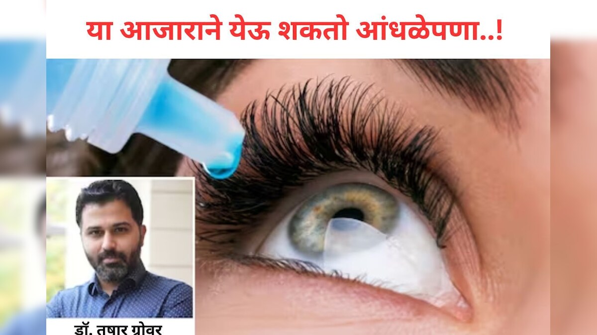 Eye Care Tips : ग्लुकोमा हा डोळ्यांचा सर्वात धोकादायक आजार ...