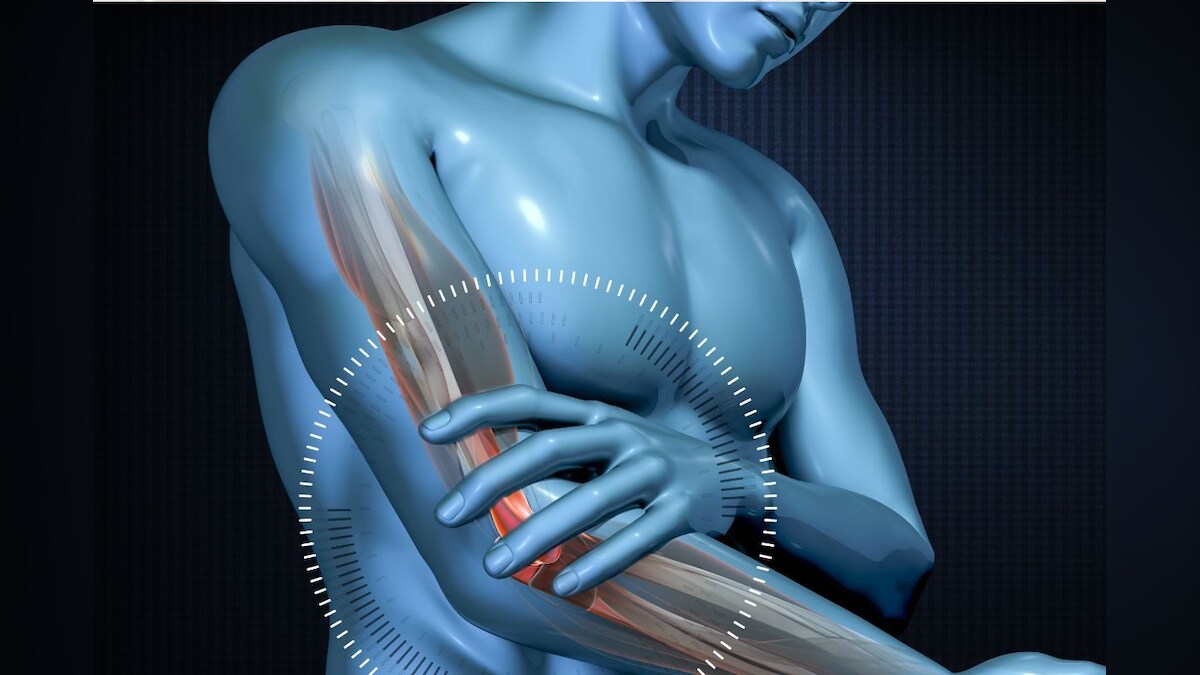 Artificial Elbow : एम्‍स-IIT दिल्‍लीने बनवले आर्टिफिशियल कोपर; उचलू ...