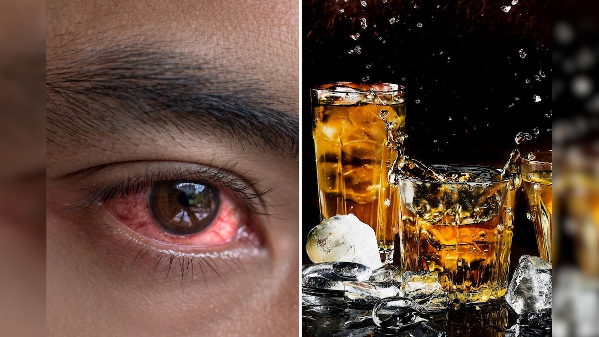 Interesting Facts : दारू प्यायल्यानंतर डोळे लाल का होतात? अनेकांना ...
